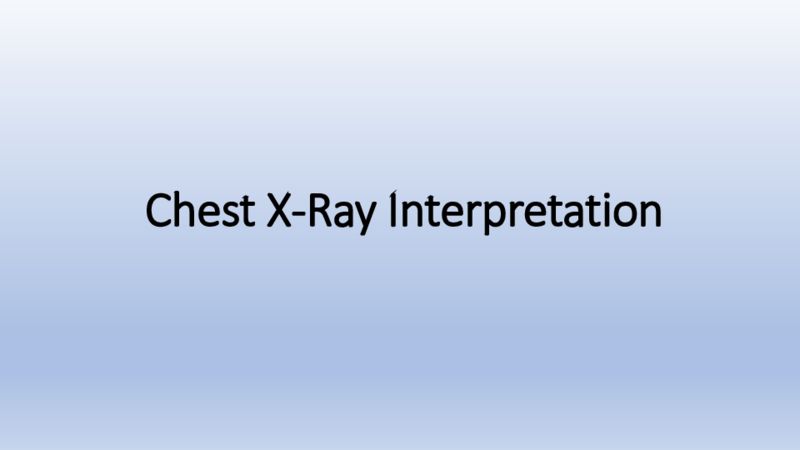 Chest X-ray Interpretation - ppt | Content | MedAll