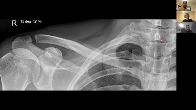 MSK Radiology Part 1: Upper Limb X-ray Interpretation | Content | MedAll