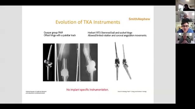History of total knee replacements | Frank Foley from Smith and Nephew ...