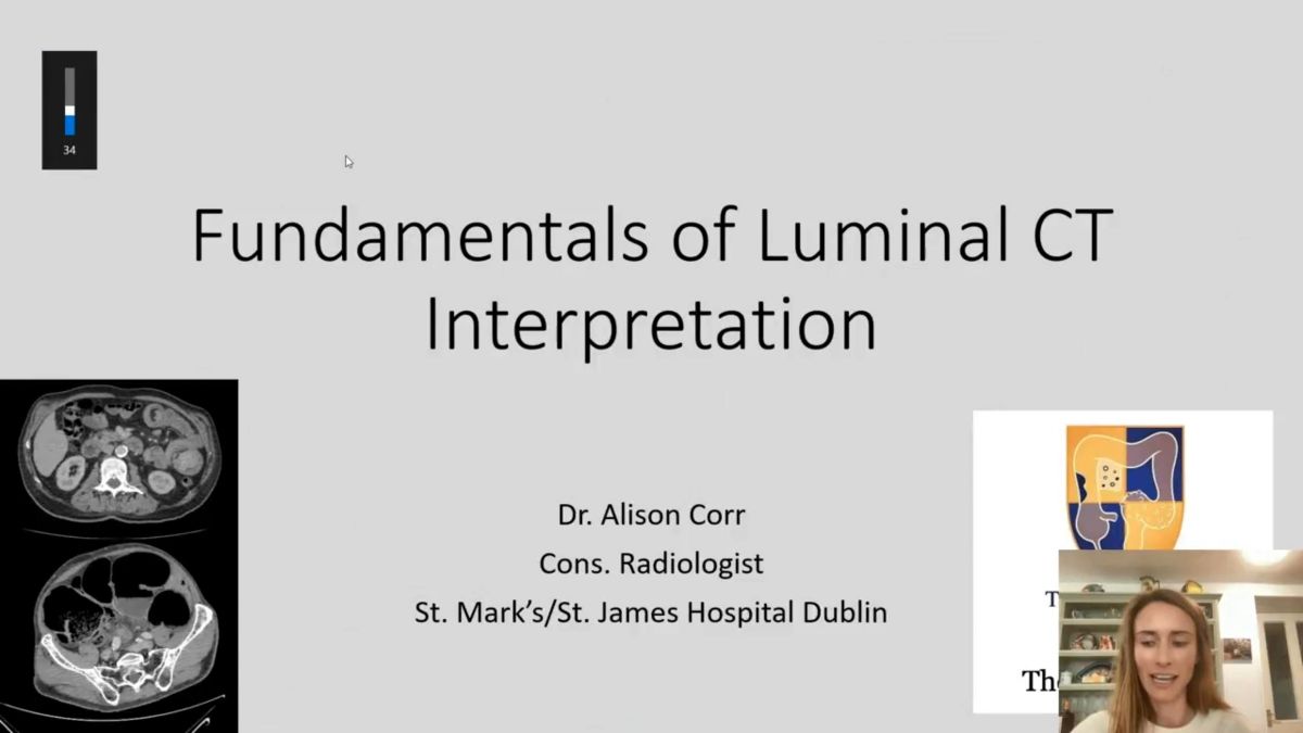 Session 4- Ward round- Radiology, How to read CT scans (Pre-recorded ...
