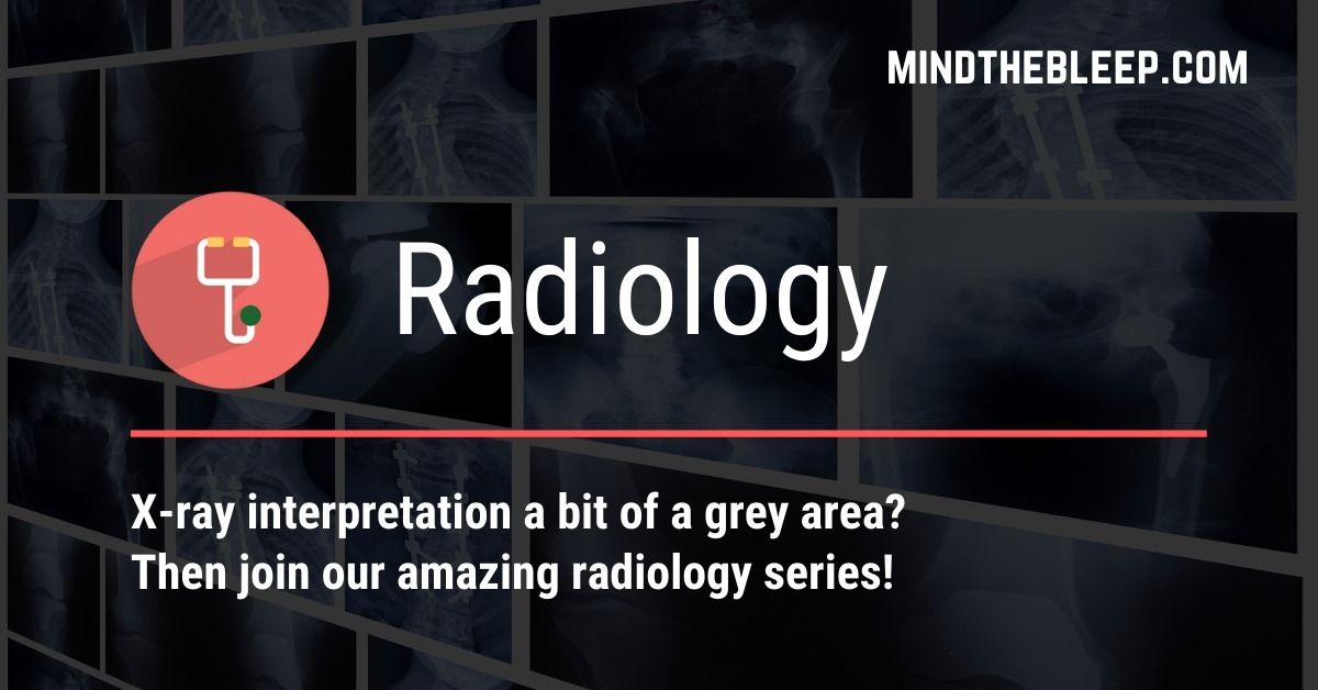 MIND THE BLEEP RADIOLOGY SERIES 2024: Chest X-Rays | Event listing | MedAll