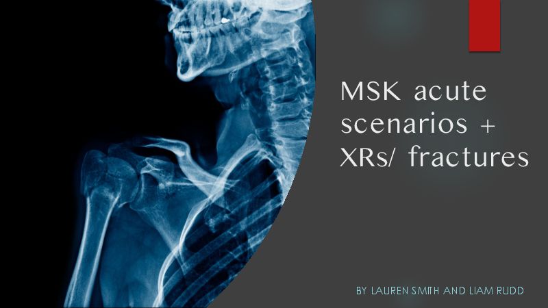 MSK acute scenarios X-rays and fractures | Content | MedAll