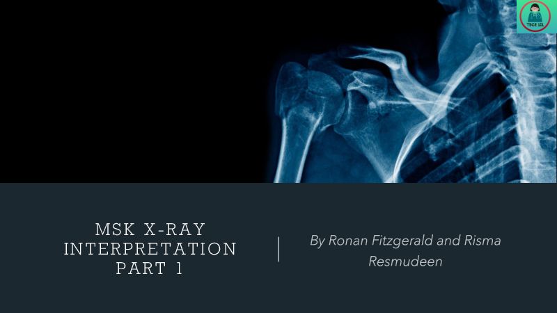 MSK X-ray data interpretation | Content | MedAll