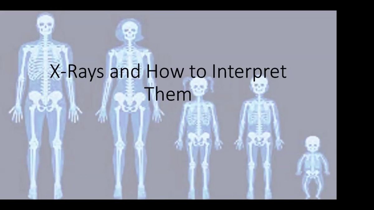 X Rays and how to interpret them | Content | MedAll