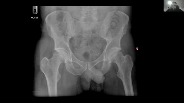 MSK Radiology Part 2: Lower Limb X-ray Interpretation | Content | MedAll