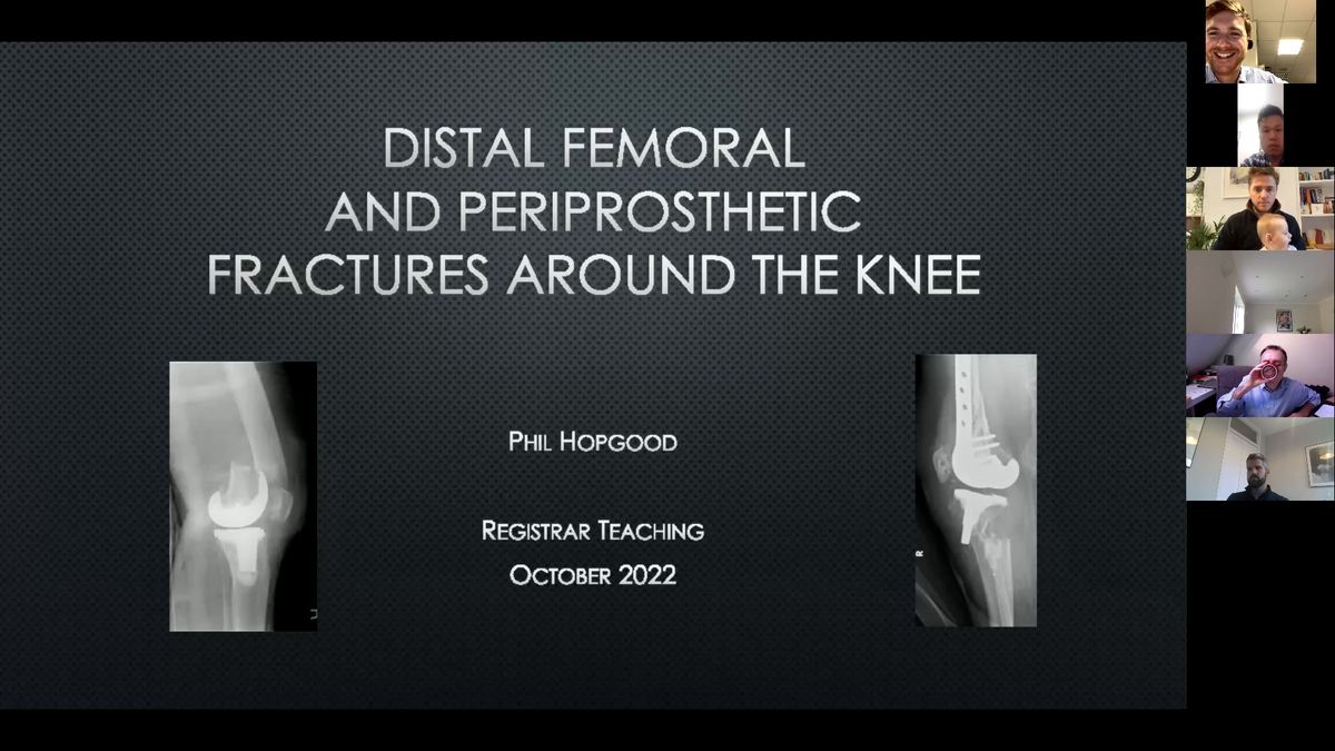 Periprosthetic Distal Femoral Fractures | Content | MedAll
