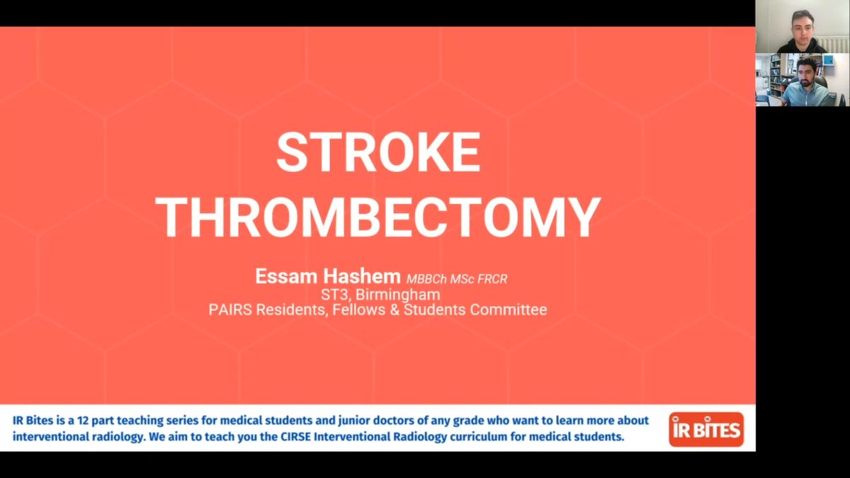 IR Bites - Stroke Thrombectomy | Content | MedAll