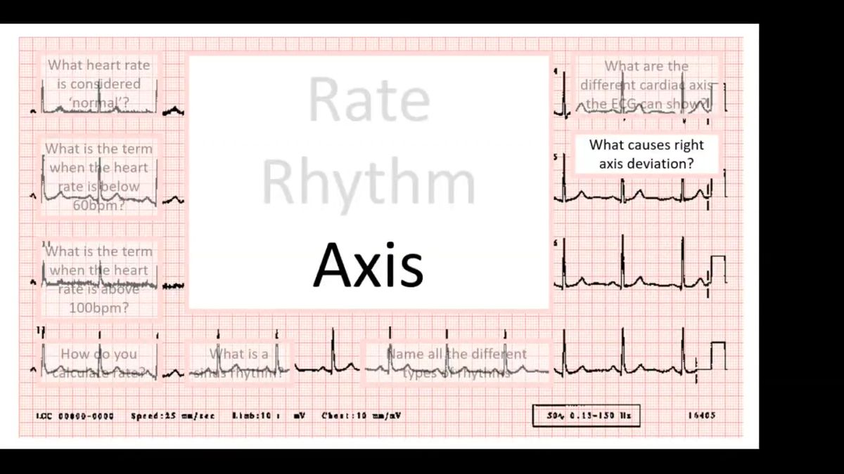ECG | Content | MedAll